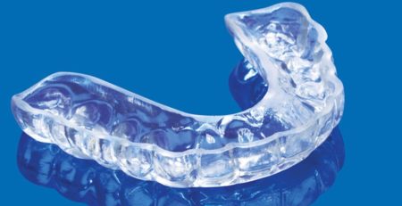 Splints for Teeth Grinding / Bruxism - Mosman Village Dentistry